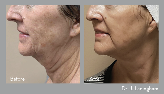 Introducing New Wellness Treatments at Sphere - Sphere Optometry - Eye ...