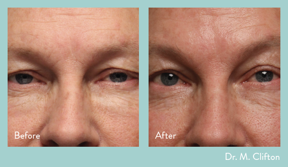 Introducing New Wellness Treatments at Sphere - Sphere Optometry - Eye ...