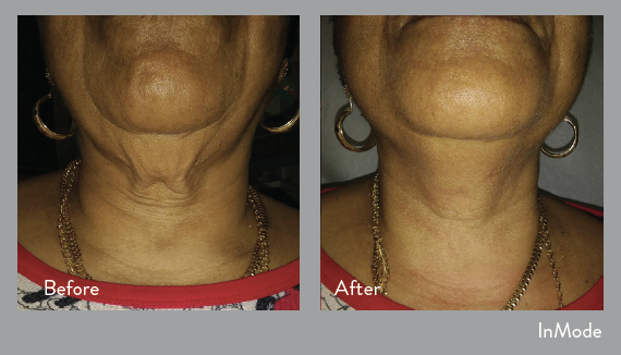 Introducing New Wellness Treatments at Sphere - Sphere Optometry - Eye ...