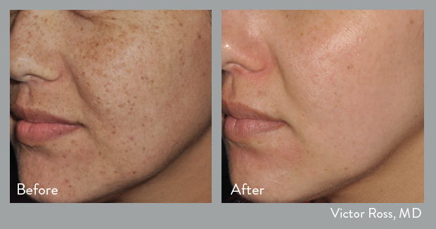 Introducing New Wellness Treatments at Sphere - Sphere Optometry - Eye ...